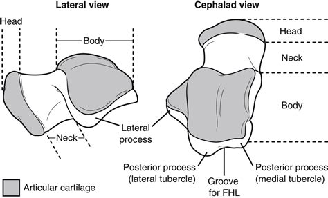 Surgical Management Of Fractures Of The Talus Musculoskeletal Key