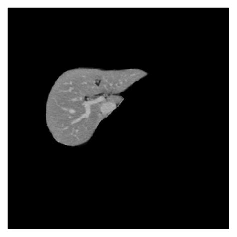 Segmentation Results Of Liver Sequences Download Scientific Diagram