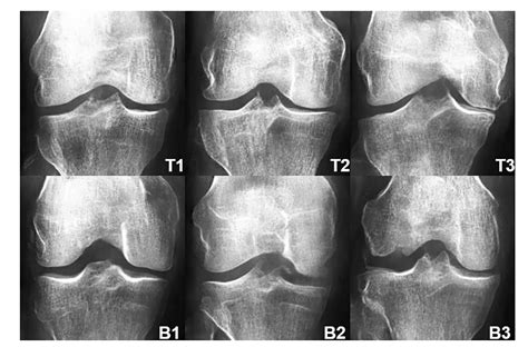 Latest Artificial Intelligence Research Presents Generative Adversarial Neural Networks Capable