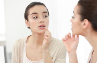 How To Make Scabs On Lips Heal Faster Lipstutorial Org