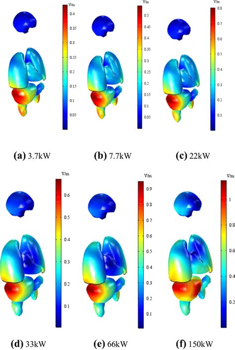 Induced Electric Field Intensity Distribution Of Human Organs At