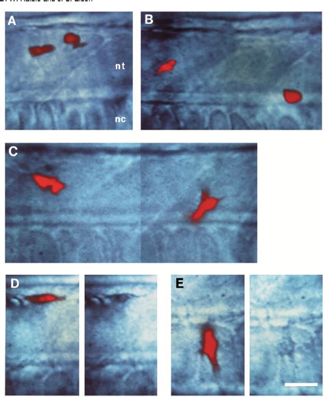 Figure 1 From Restriction Of Neural Crest Cell Fate In The Trunk Of The