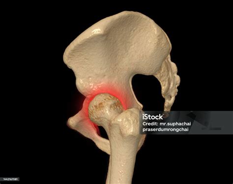 Ct Scan Of Pelvic Bone And Hip Joint 3d Rendering For Diagnosis