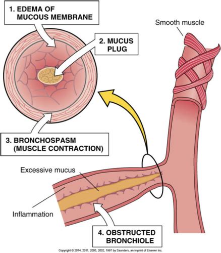 Chapter 13 Part 3 Flashcards Quizlet
