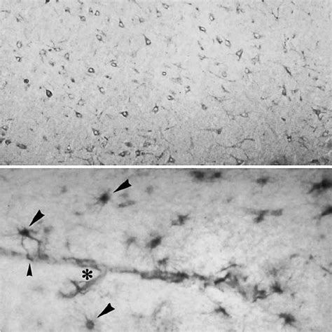 Schematic Representation Of The Proposed Astrocyte Neuron Lactate Download Scientific Diagram
