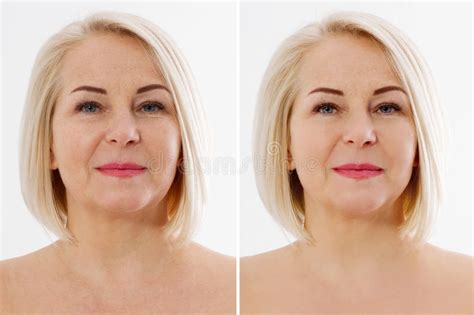 Closeup Before After Beauty Middle Age Woman Face Portrait Before