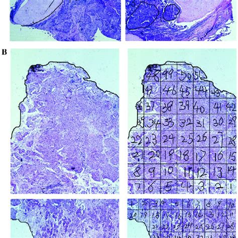 Distribution Of The Epidermal Growth Factor Receptor Mutation Was Download Scientific Diagram