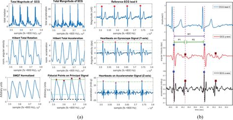 Scg And Gcg Signal Processing Scheme For Heartbeat Detection And Download Scientific Diagram