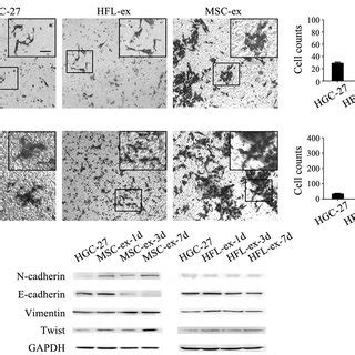 MSC Ex Induce The EMT In Gastric Cancer Cells MSC Ex Promoted The A Download Scientific