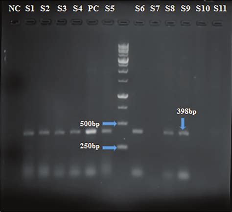 The First Round Of Polymerase Chain Reaction For The Detection Of Download Scientific Diagram