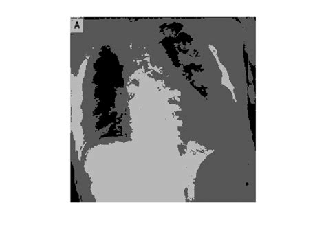 the segmented image test 8 by the comparative methods when the