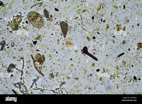 Soil Microorganisms Close Up Under The Microscope In A Soil Samlple