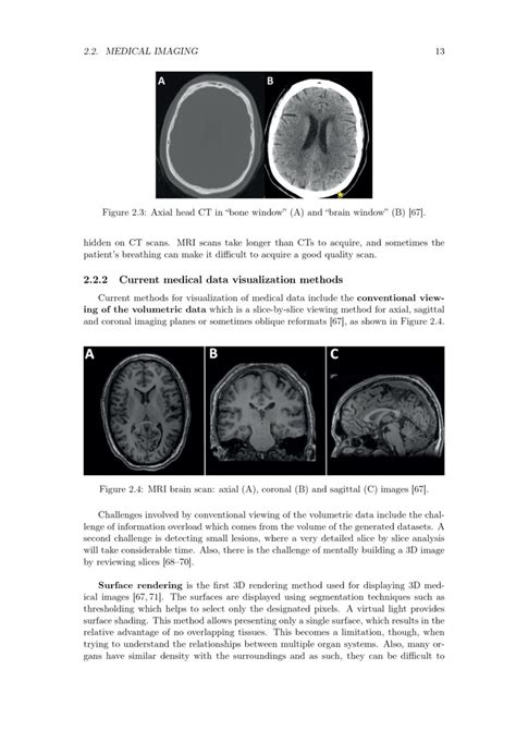 Holographic Visualisation Of Radiology Data And Automated Machine Learning Based Medical Image