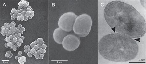 Electron Micrographs Em Of Putative Micrococcus Spp Isolated From Download Scientific