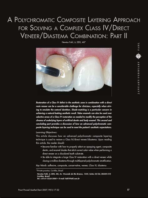 Class Iv Restorations Polychromatic Pdf Tooth Enamel Dental Composite