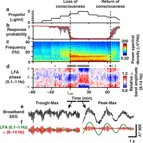 Figure 1 From A Transition In Brain State During Propofol Induced