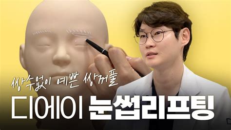 쌍수 없이 쌍꺼풀 만들기 눈썹 리프팅으로 가능하다 디에이성형외과 Youtube