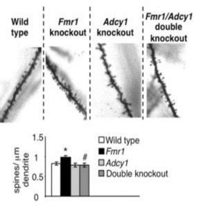 Tracking The Causal Genetics Of Fragile X BioTechniques
