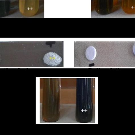 A I Biochemical Characterization Of Isolated Bacteria Using Various