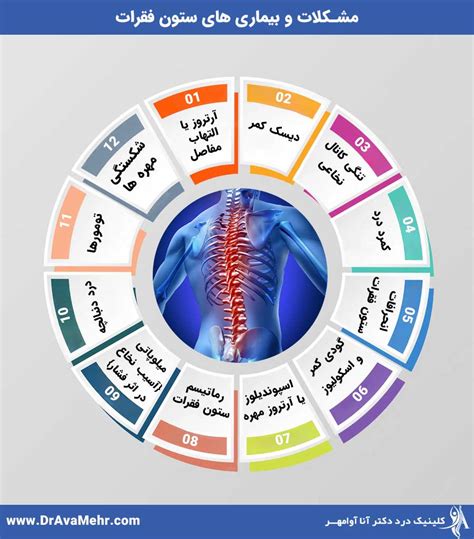 بهترین متخصص ستون فقرات در تهران کیست؟ دکتر آنا آوامهر