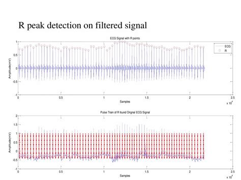 Optimal Ecg Data Compression For An E Health Transmission System