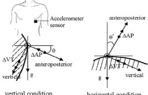 Figure 2 From Estimation Of Respiratory Waveform Using An Accelerometer