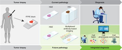 Figure 1 From Moving Spatially Resolved Multiplexed Protein Profiling Toward Clinical Oncology