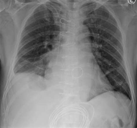 饮冰十年,难凉热血,曾经胆小又青涩的你我也成为了那群赶跟死神掰掰手腕的人! 微医(挂号网) 饮冰十年,难凉热血,曾经胆小又青涩的你我也成为了那群赶跟死神掰掰手腕的人! 微医(挂号网)