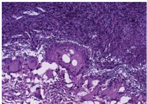Figure 7 Pathogenesis And Pathobiology Of Brucellosis In