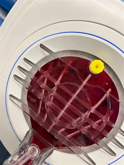 Ecls Ecmo Perfusion Vaecmo Vvecmo Oxygenator Johnny Gray