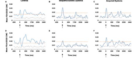 Pooled Frequency Specific Beta Corticomuscular Coherence Cmc Over