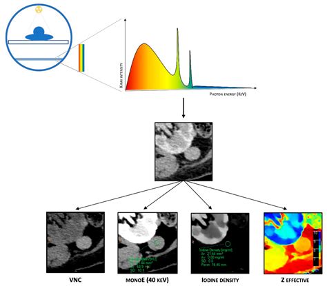 dual layer spectral computed tomography encyclopedia mdpi