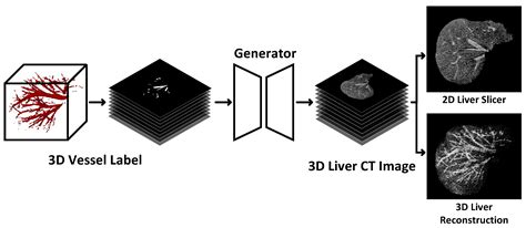 End To End 3d Liver Ct Image Synthesis From Vasculature Using A Multi