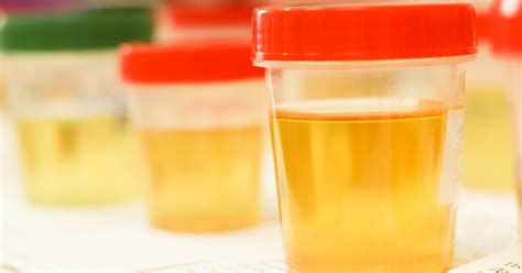 أسباب كثرة التبول بكميات قليلة ويب طب