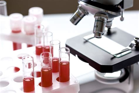 Hemoglobin A1c Test Shop Lab Test Prices Starting 11 99 No Doctor Visit Required