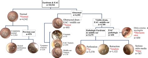 Automated Diagnosis Of Ear Disease Using Ensemble Deep Learning With A