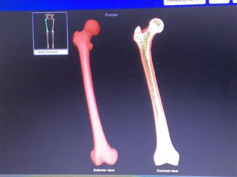 Lab Bone Histology And Long Bone Anatomy Flashcards Quizlet