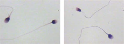 Sperm Images For DiffQuik Staining Download Scientific Diagram