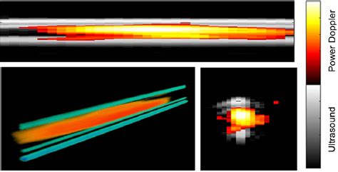Figure 1 From High Voltage Bias Switching Electronics For Volumetric Imaging Using