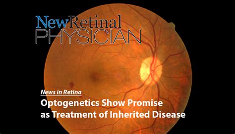 Optogenetics Show Promise As Treatment For Inherited Disease New Retinal Physician