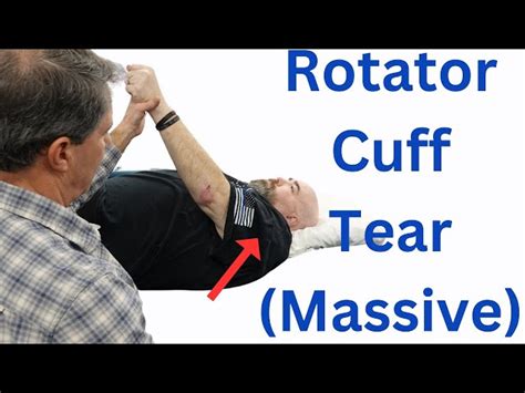 Supraspinatus Tear Symptoms