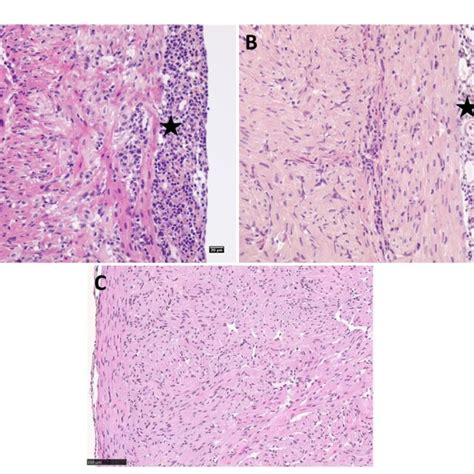 Prv 1 Challenged Atlantic Salmon Post Smolts Heart Ventricle Showing Download Scientific