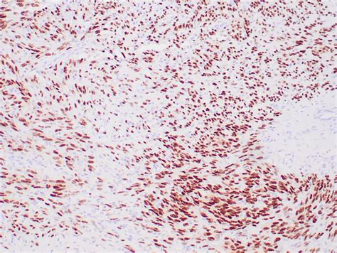 Sox 10 Ivd Monoclonal Antibody Zeta Corporation