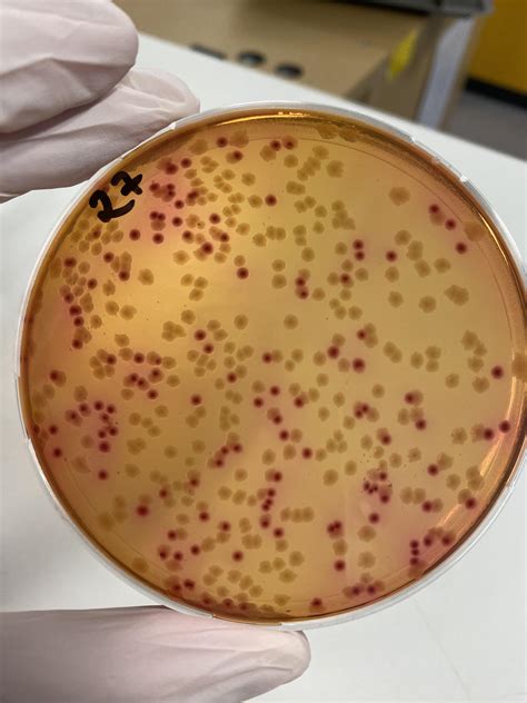 Beautiful Co Culture Of Li And Salmonella Rmicrobiology