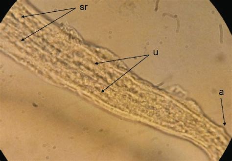 Posterior End Of An Adult Female Worm Lateral View A Female Worm At Download Scientific