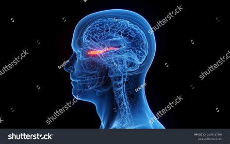 Hemianopsia Over 5 Royalty Free Licensable Stock Illustrations And Drawings Shutterstock