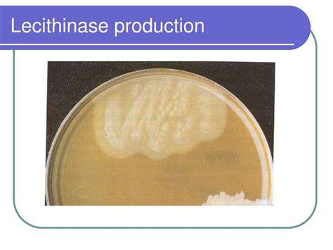 Ppt The Anaerobes Powerpoint Presentation Free Download Id3326516