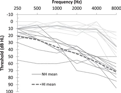 Audiometric Thresholds In Db Hl As A Function Of Frequency For Download Scientific Diagram