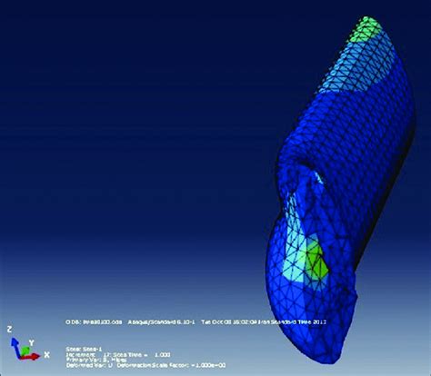 Pattern Of Stress Distribution In Bone Around Long 10 Mm Implants Download Scientific Diagram