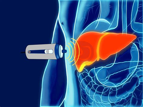 Get Reliable Results With Fibroscan The Gi Docs